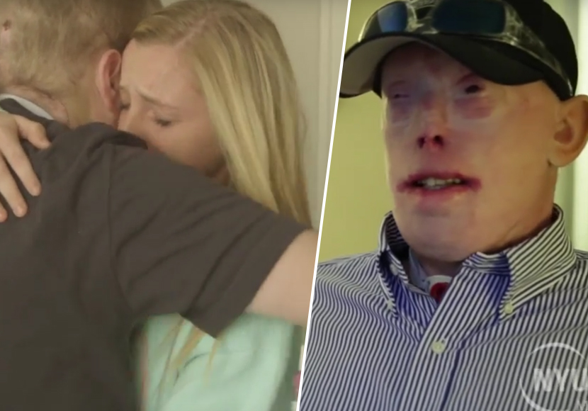 Rekord: Feuerwehrmann erhält komplett neues Gesicht - UnserTirol24